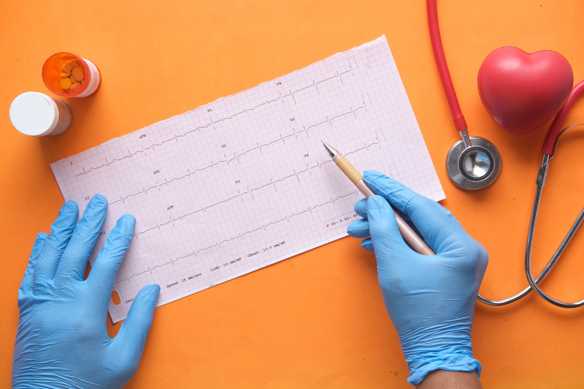 How to perform ECG categorization and detect arrhythmia | KNIME How to perform ECG categorization and detect arrhythmia | KNIME